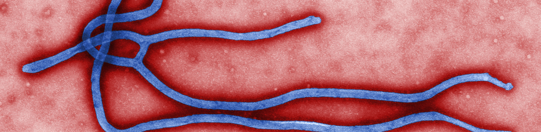 Regional Emerging Special Pathogen Treatment Center | Denver Health