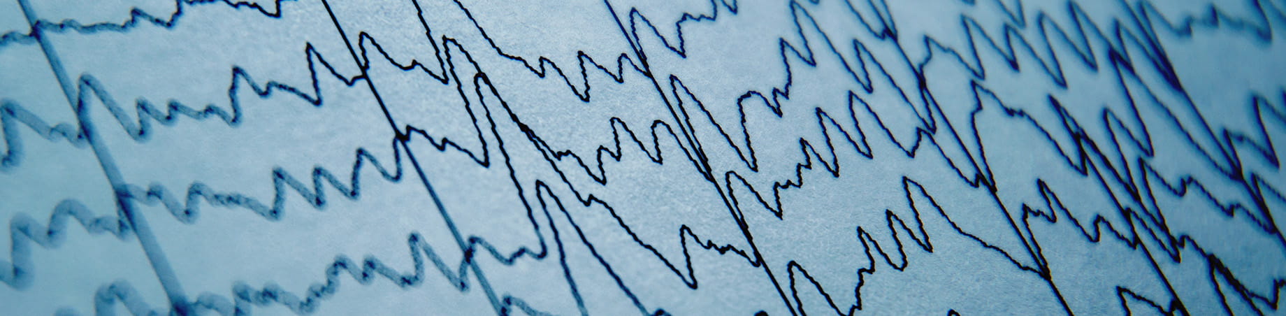 Epilepsy Monitoring Unit | Denver Health