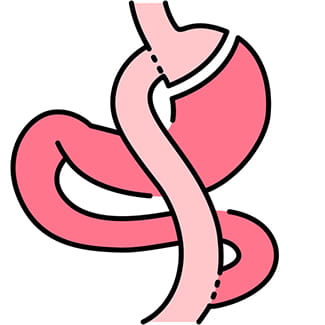 Before and After Bariatric Surgery Series | Denver Health